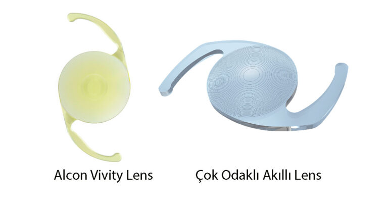 Alcon Vivity Lens Nedir? - Doç. Dr. Fatih Çakır Gündoğan